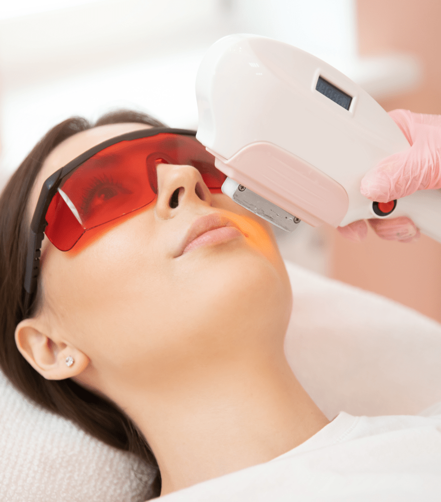 Mustache epilation - laser removal of mustache in women